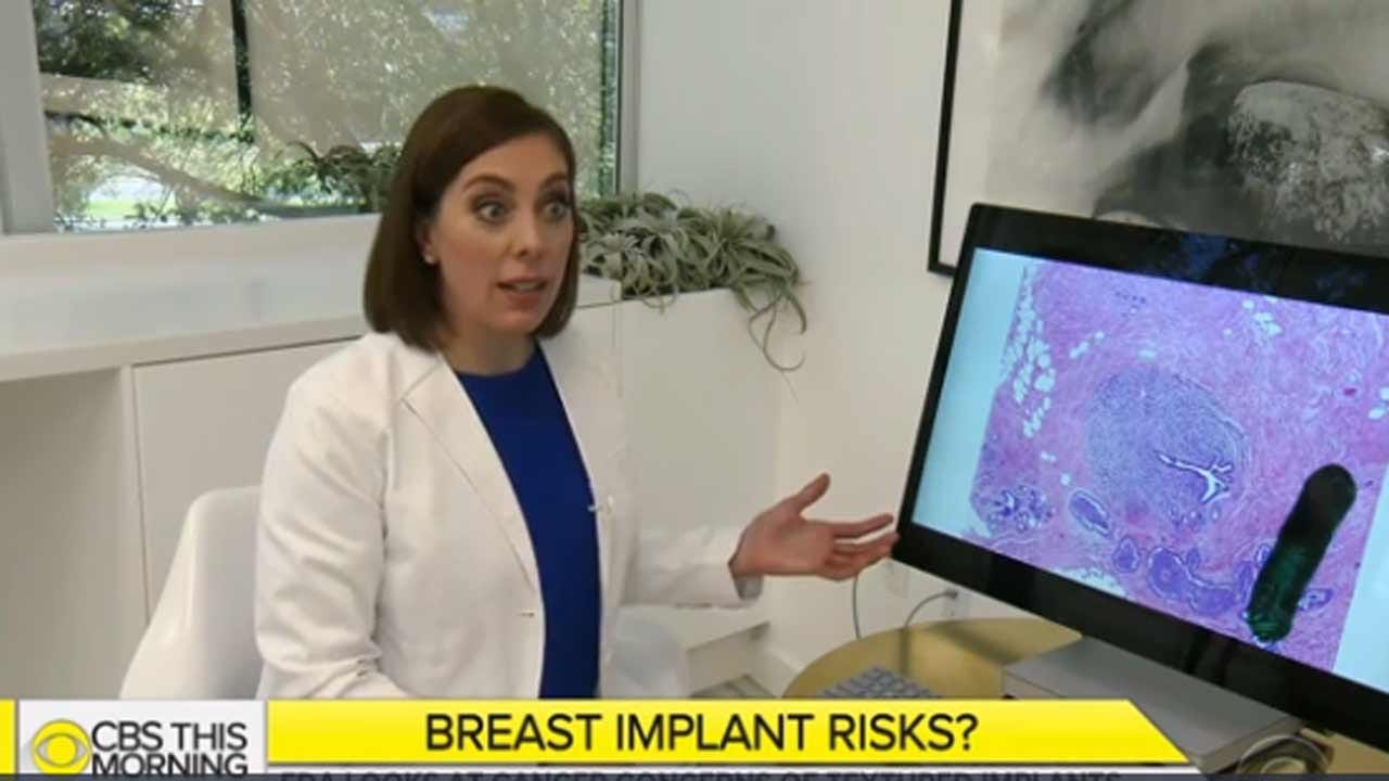 FDA Meets To Discuss Cancer Cases In Women With Breast Implants