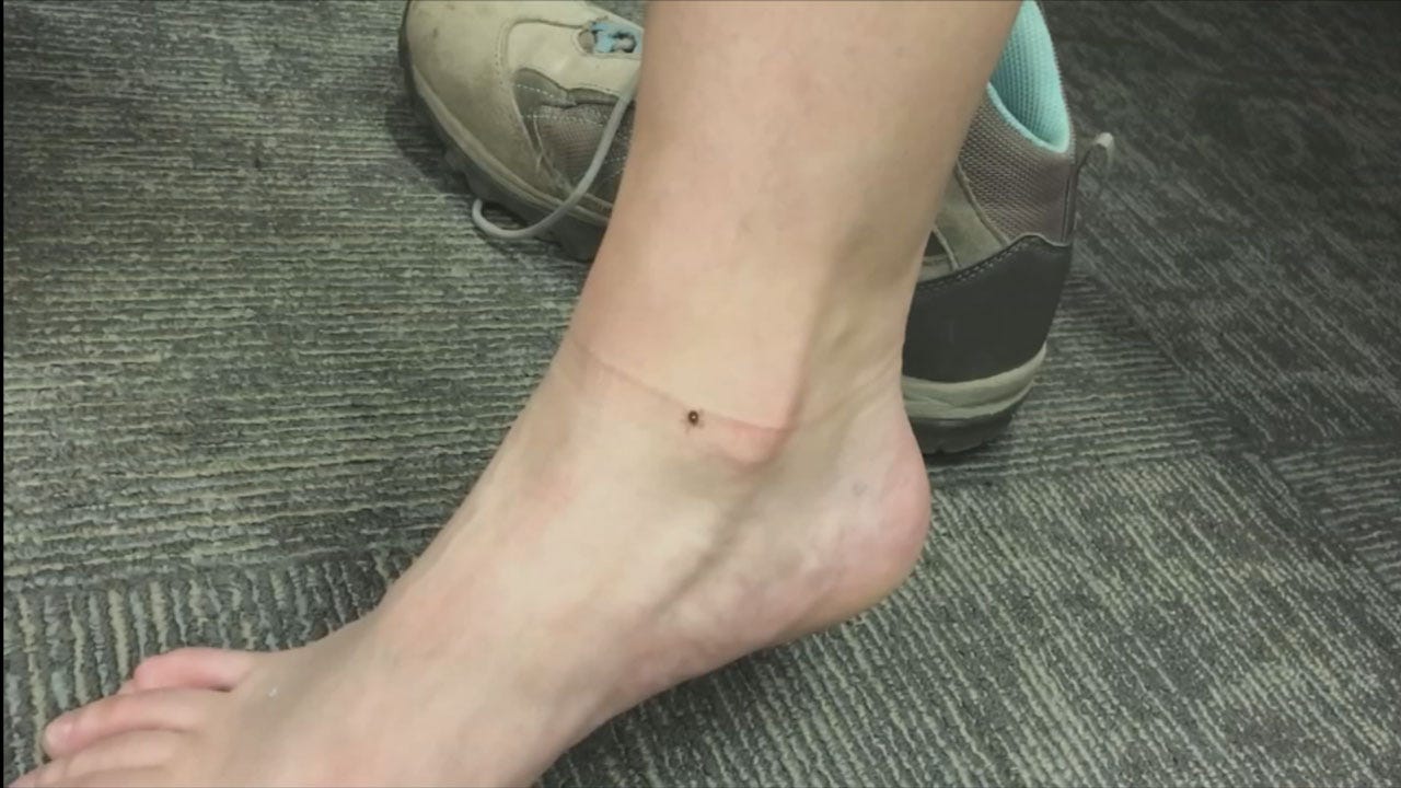 OCCHD Seeing Uptick In Tick Bites And Illness