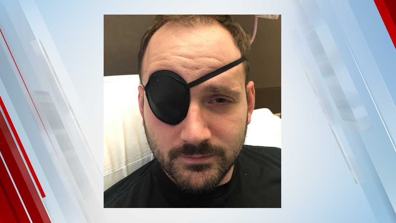 28-year-old Oklahoma Man Suffers Stroke From Cracking His Neck