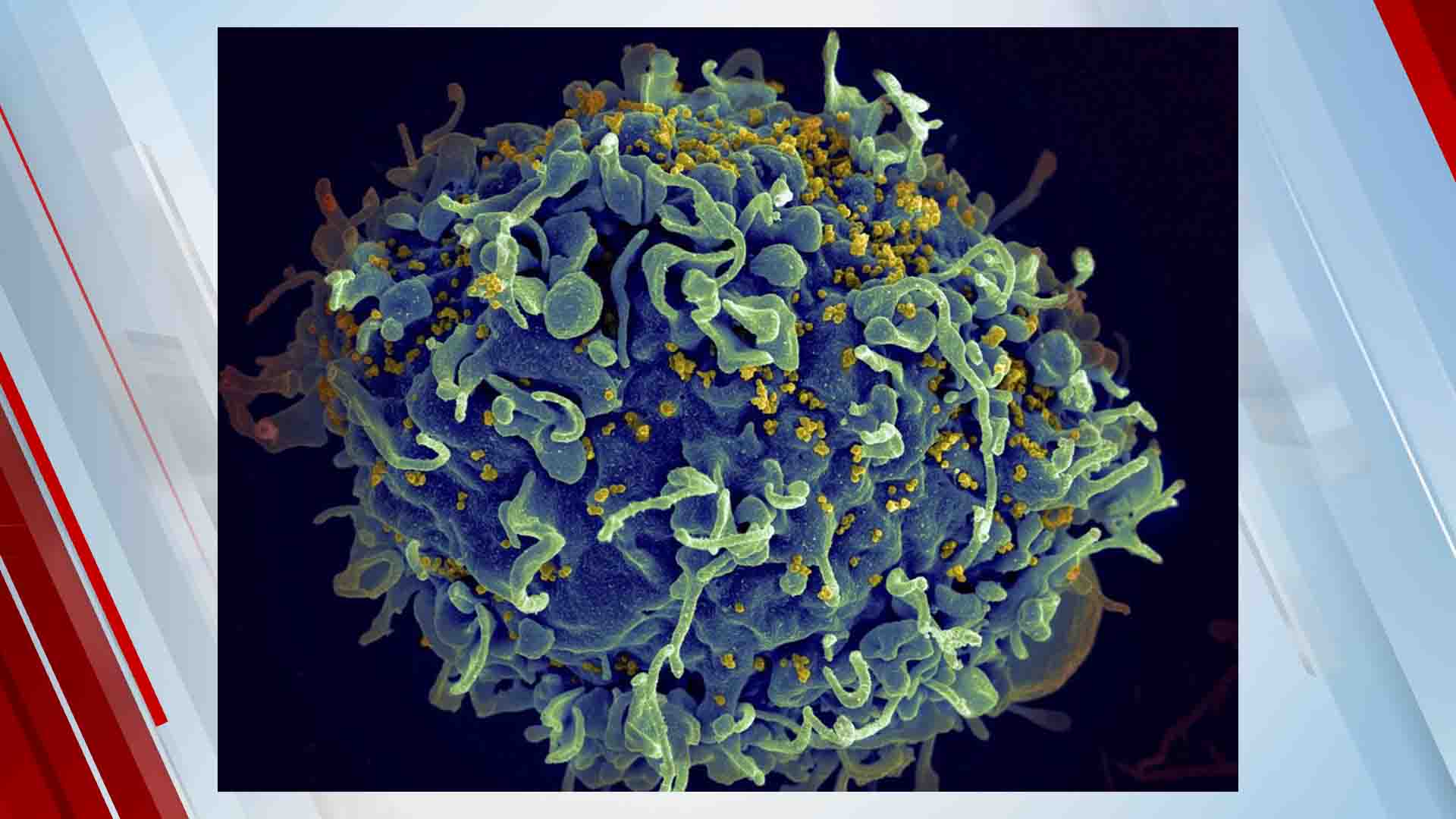 Climate Change May Increase Risk Of New Infectious Diseases